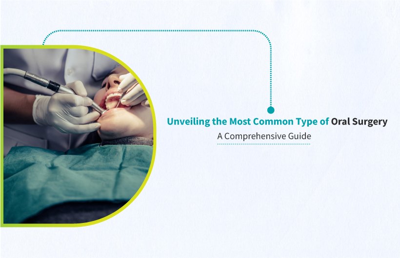 The Most Common Oral Surgeries: A Comprehensive Guide
