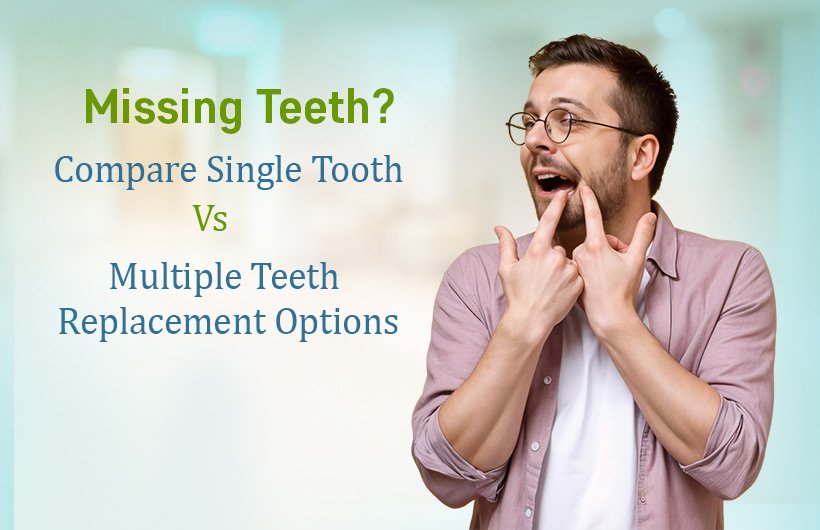 Single vs. Multiple Teeth Replacement: What’s Better?